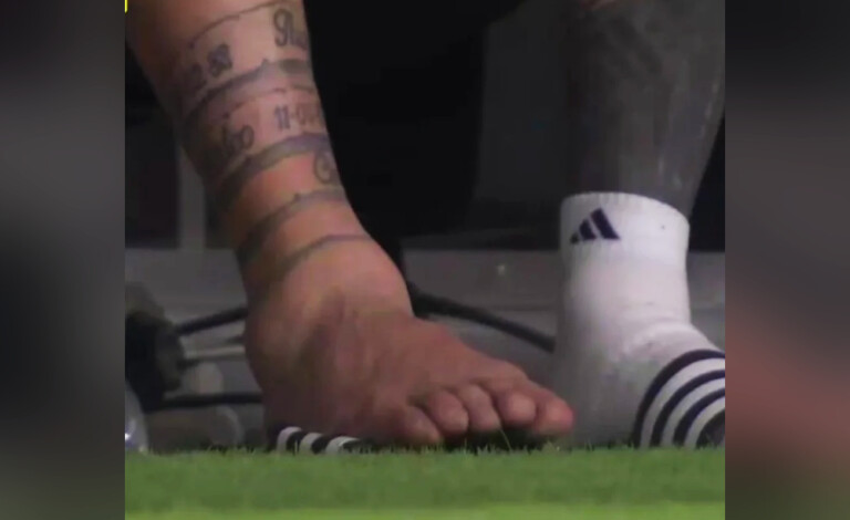Copa América: la impactante imagen del tobillo de Messi - Primera Edición